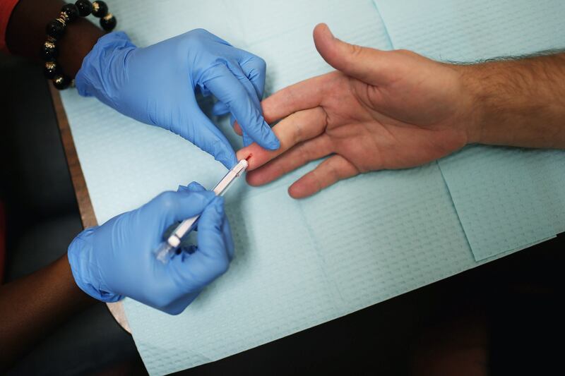 New policy keeps HIV-positive troops deployable, bars involuntary ...