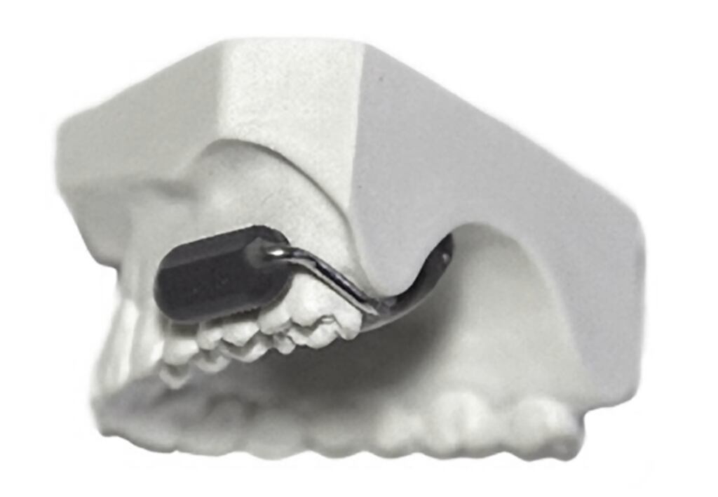 This new wireless communication device fits on your teeth